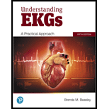Understanding EKGs: A Practical Approach | Wallace State Community ...